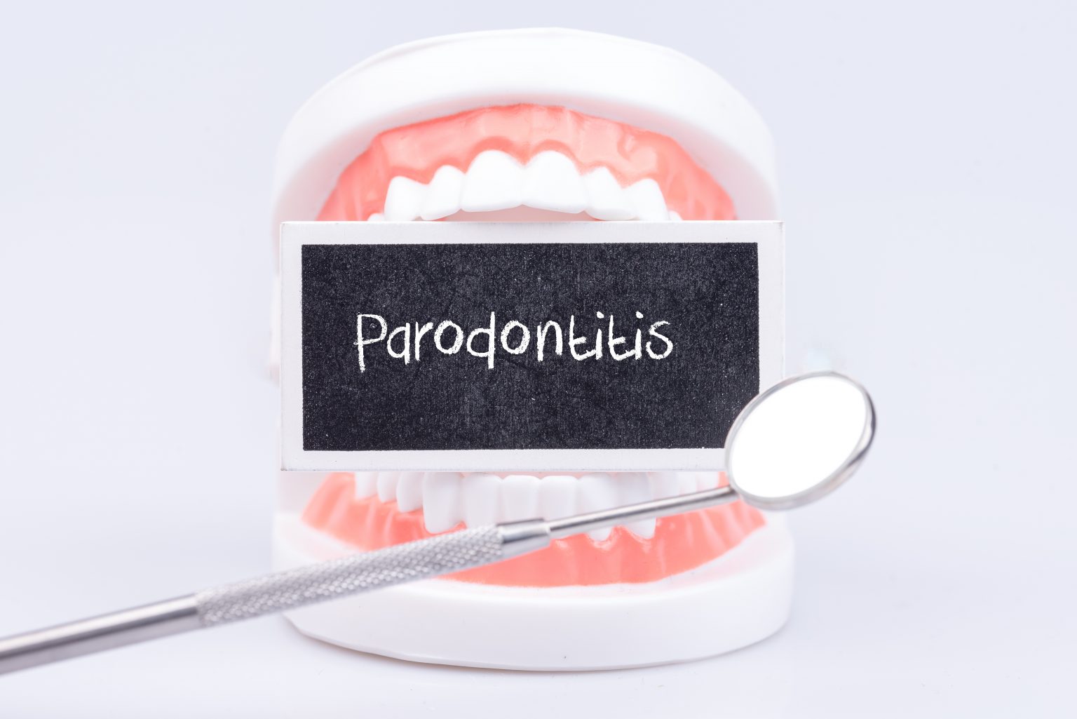 BDDH Seminarbuchung –Subgingivale Reinstrumentierung – ein aktuelles ...